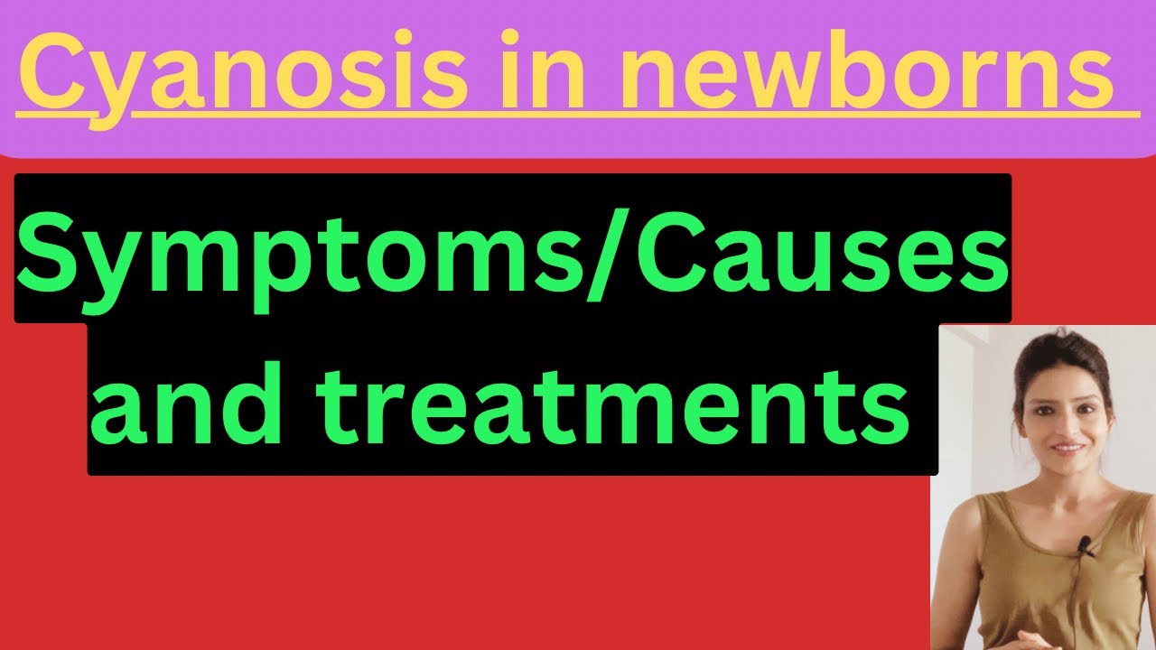 Cyanosis in babies|| causes/ symptoms and treatments - YouTube