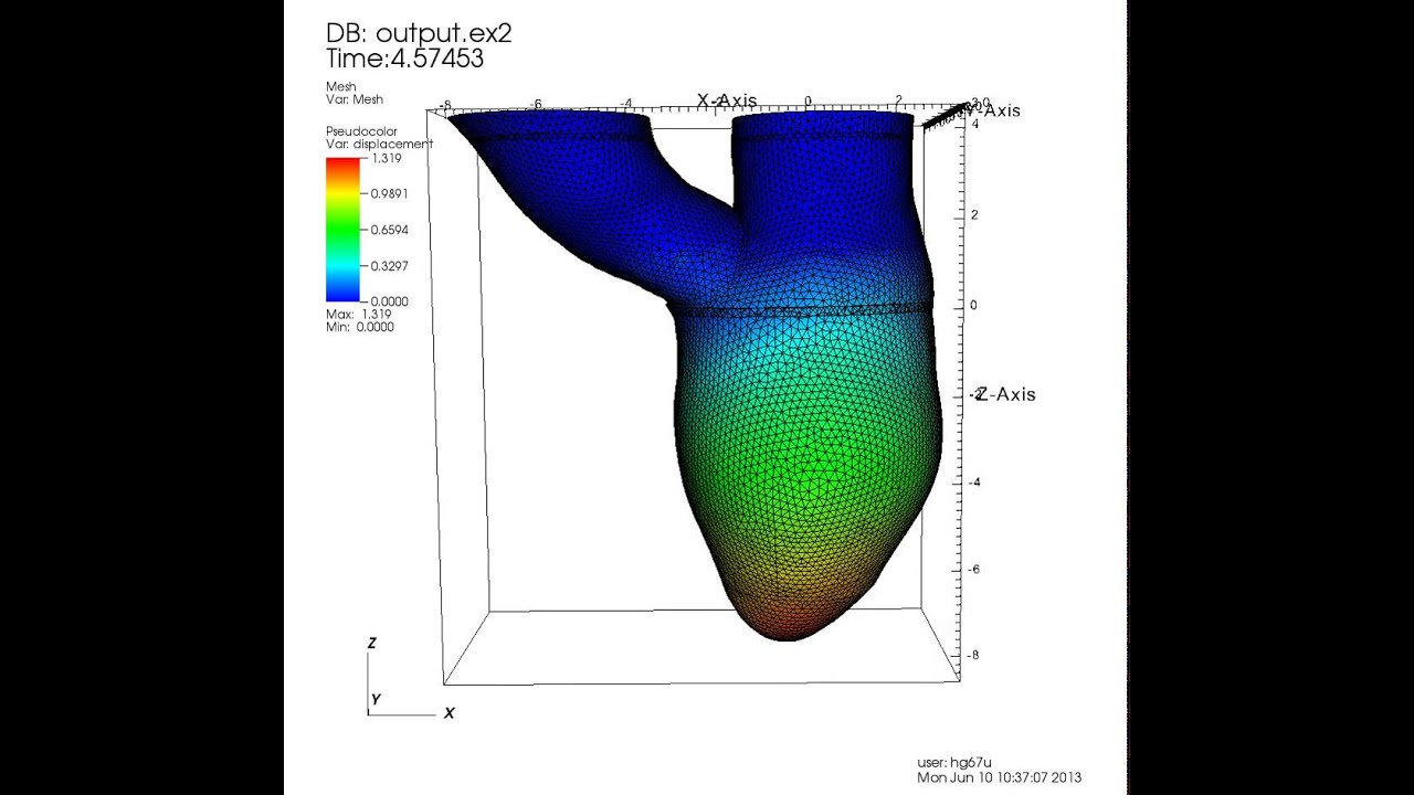 The Left ventricular model with inflow and outflow tract (1) - YouTube