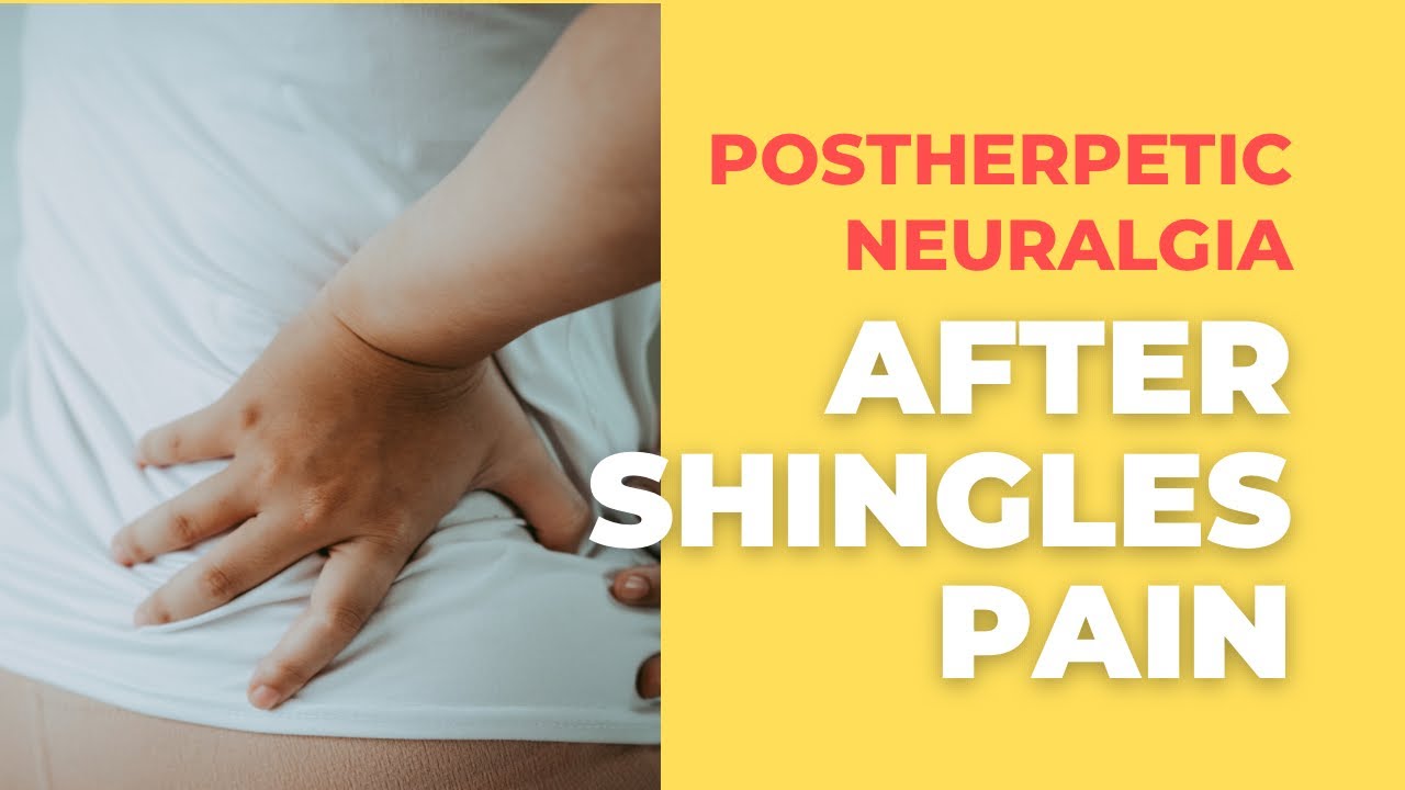 Post herpetic Neuralgia-Terrible Pain After Shingles - YouTube