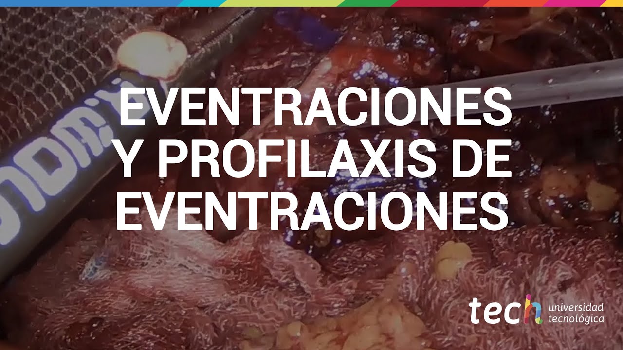 Resumen de Eventraciones y Profilaxis de Eventraciones | TECH ...