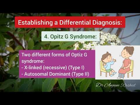 Orbital Hypertelorism Causes, Symptoms, Diagnosis, Measurement | Wide ...
