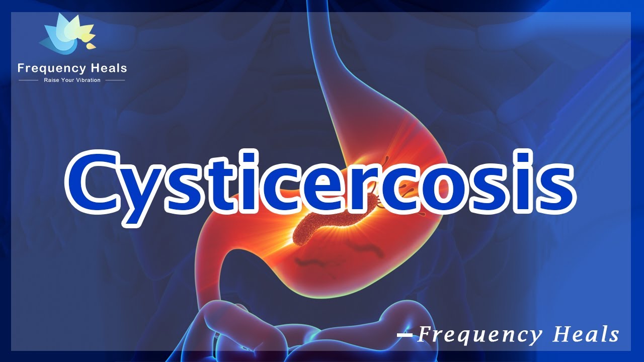 Cysticercosis Healing - Energy & Quantum Medicine - Healing Frequency ...