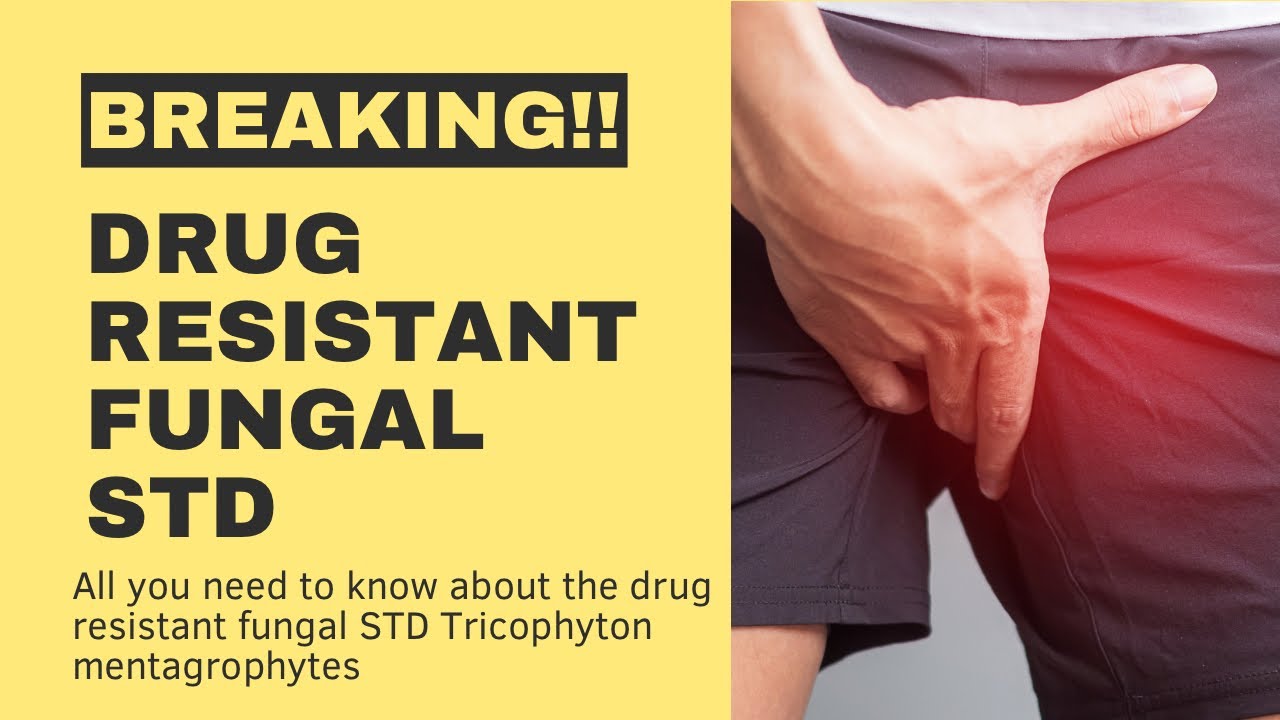 Difficult to Treat Fungal Sexually Transmitted Infection!! All You need ...
