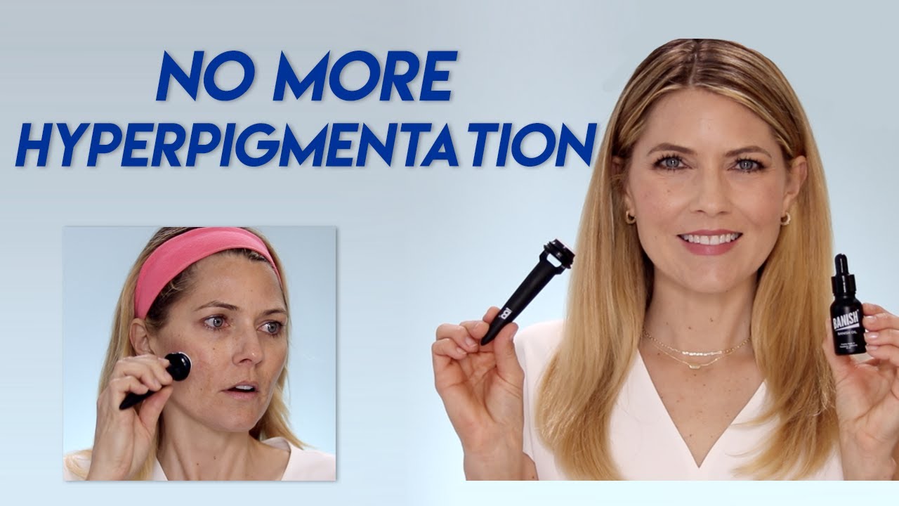 Stamp Away Hyperpigmentation and Acne Scars with The Banisher ...