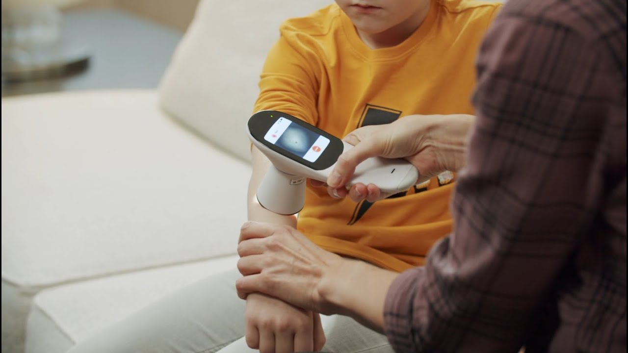 SKIN: How to properly perform the skin exam with the Higo® device ...