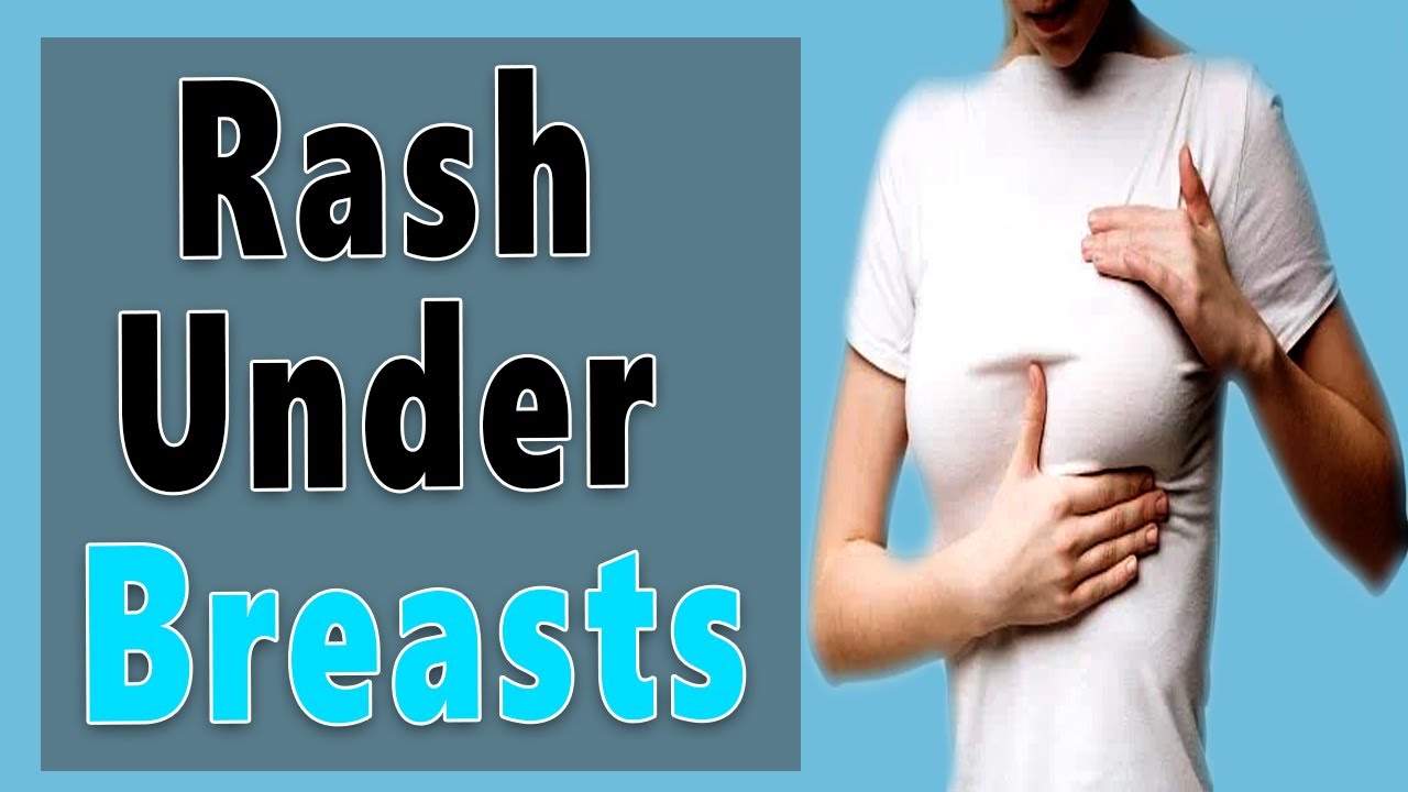 How to Get Rid of a Rash Under Breasts - YouTube