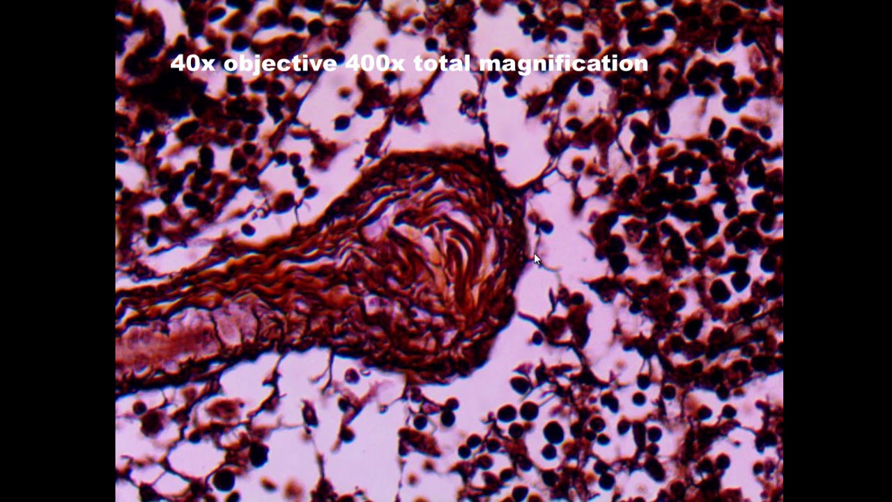 SLIDE: Reticular Tissue - YouTube