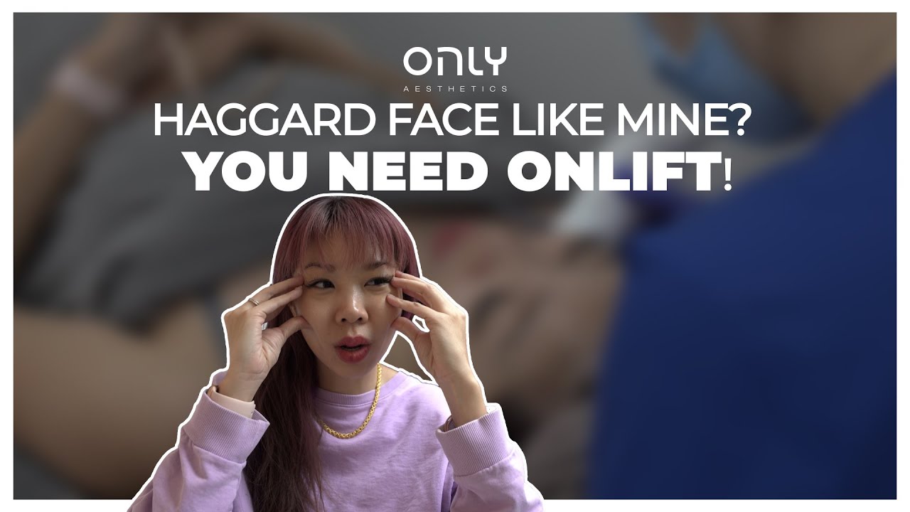 Haggard face like mine you need ONLIFT! | OnLift | Only Aesthetics ...