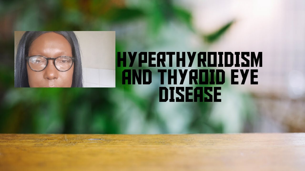 HYPERTHYROIDISM/THYROID EYE DISEASE - YouTube