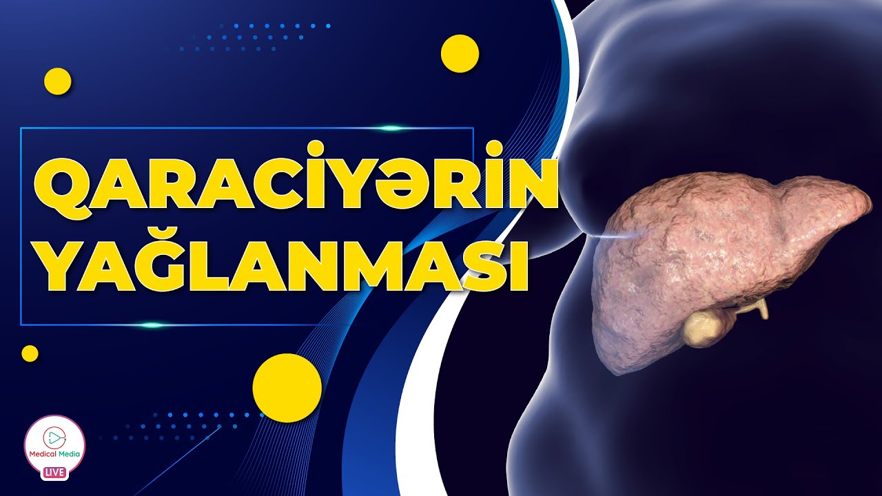 QARACİYƏR PİYLƏNMƏSİ / QARACİYƏR SİRROZUNUN MÜALİCƏSİ / QARACİYƏR ...