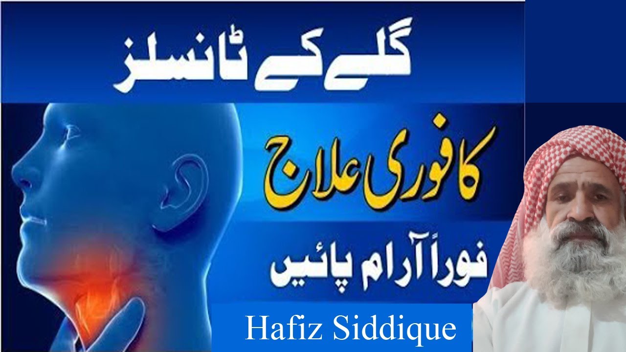 Gale Main Dard Ka Fori Ilaj | گلے کے امراض ٹانسل | Gale ke tonsils ka ...