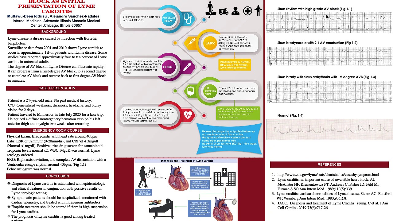 Complete 3rd Degree AV Block as initial presentation of Lyme Carditis ...