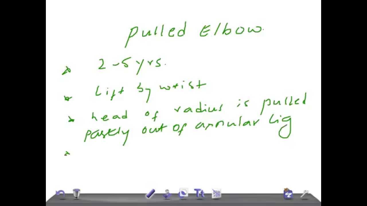 Medical Video Lecture: pulled elbow, orthopedics - YouTube