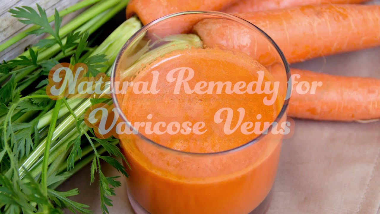 Natural Remedy for Varicose Veins - YouTube