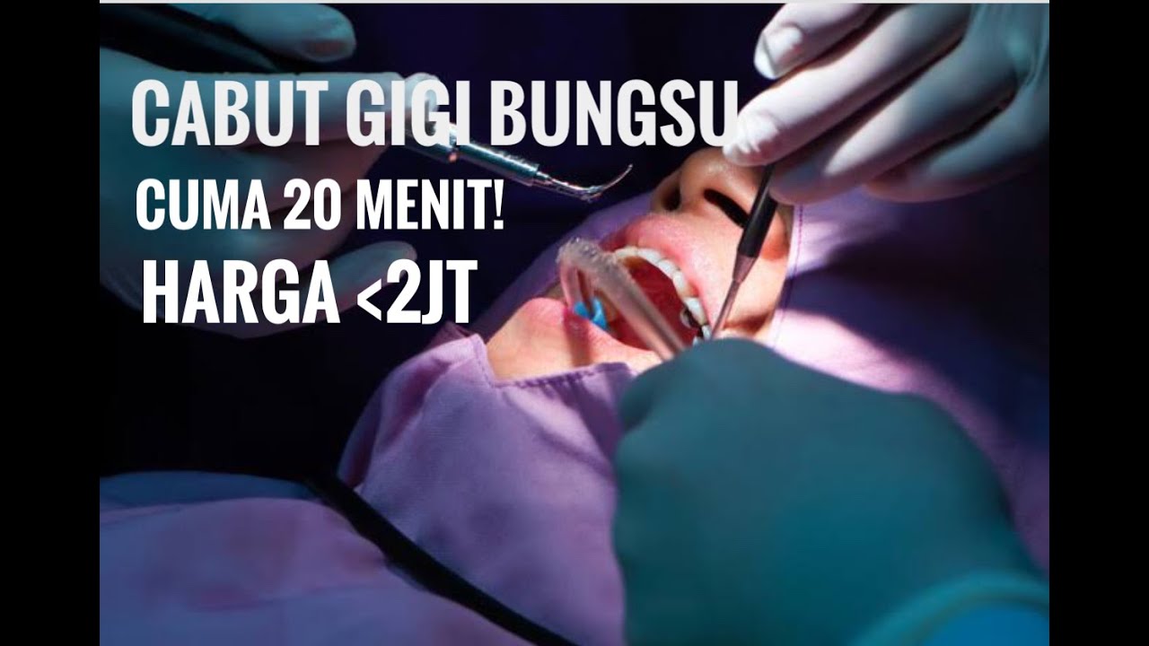 CABUT GIGI BUNGSU CUMA 20menit! TANPA OPERASI. DETAIL HARGA CABUT GIGI GERAHAM BUNGSU. - YouTube