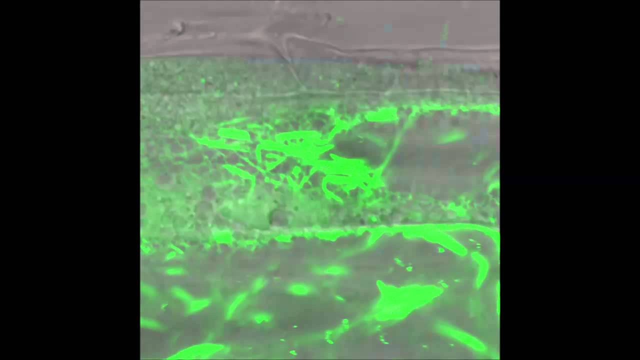 Fluorescence Dynamics In The Endoplasmic Reticulum Of A