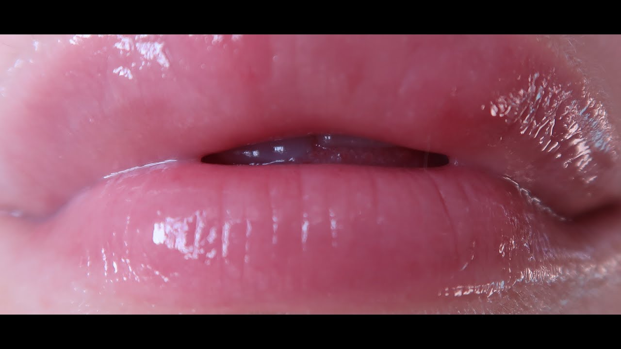 LABBRA A CANOTTO SENZA CHIRURGO SOLO CON QUESTO RIMEDIO NATURALE ...