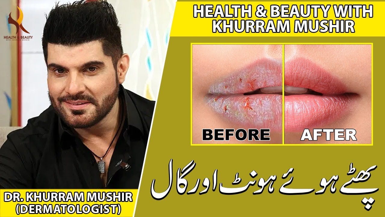 Cracked Lips & Cheeks Treatment, 100% Beneficial & harmless Tips for ...