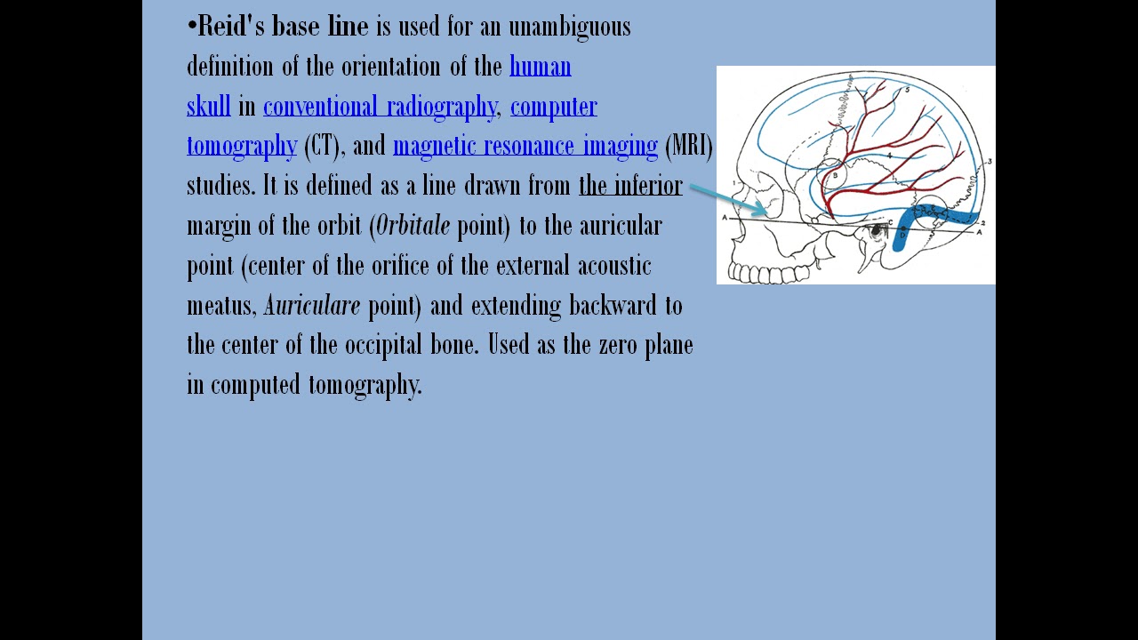 Reids base line - YouTube