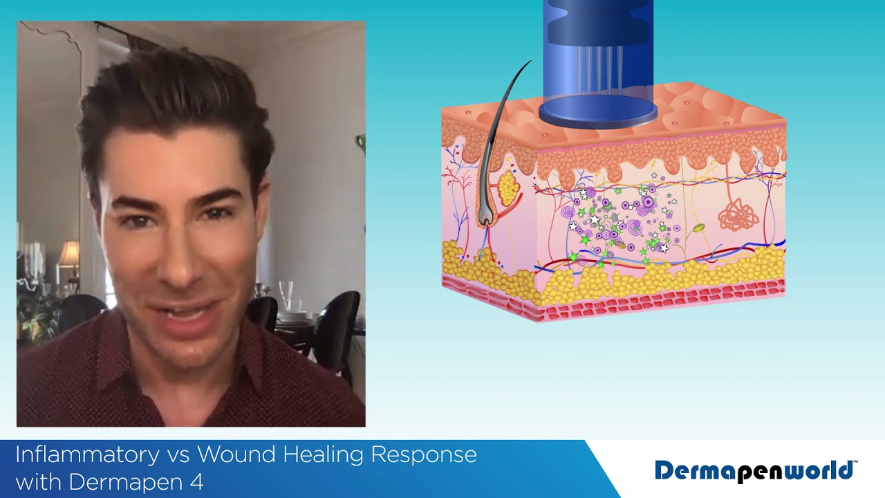 Dermapen and Dp Dermaceuticals