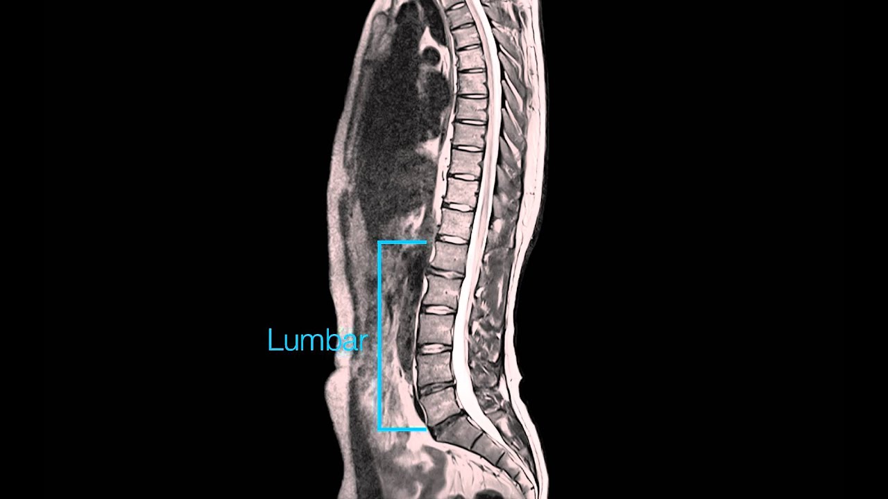 Pott Pathophysiology 2 - YouTube