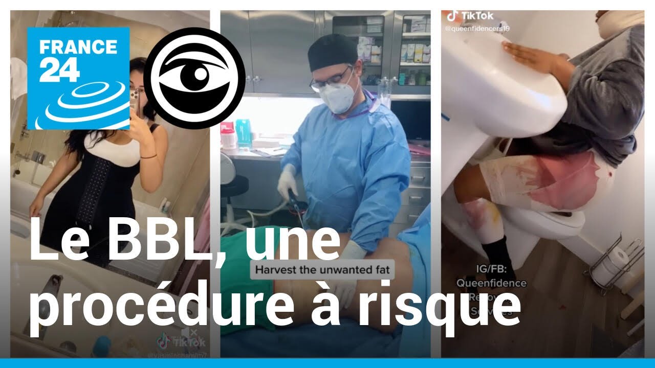 Brazilian Butt Lift : une opération de chirurgie esthétique dangereuse ...
