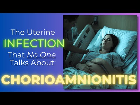 Chorio: What Every Pregnant Woman Should Know - YouTube