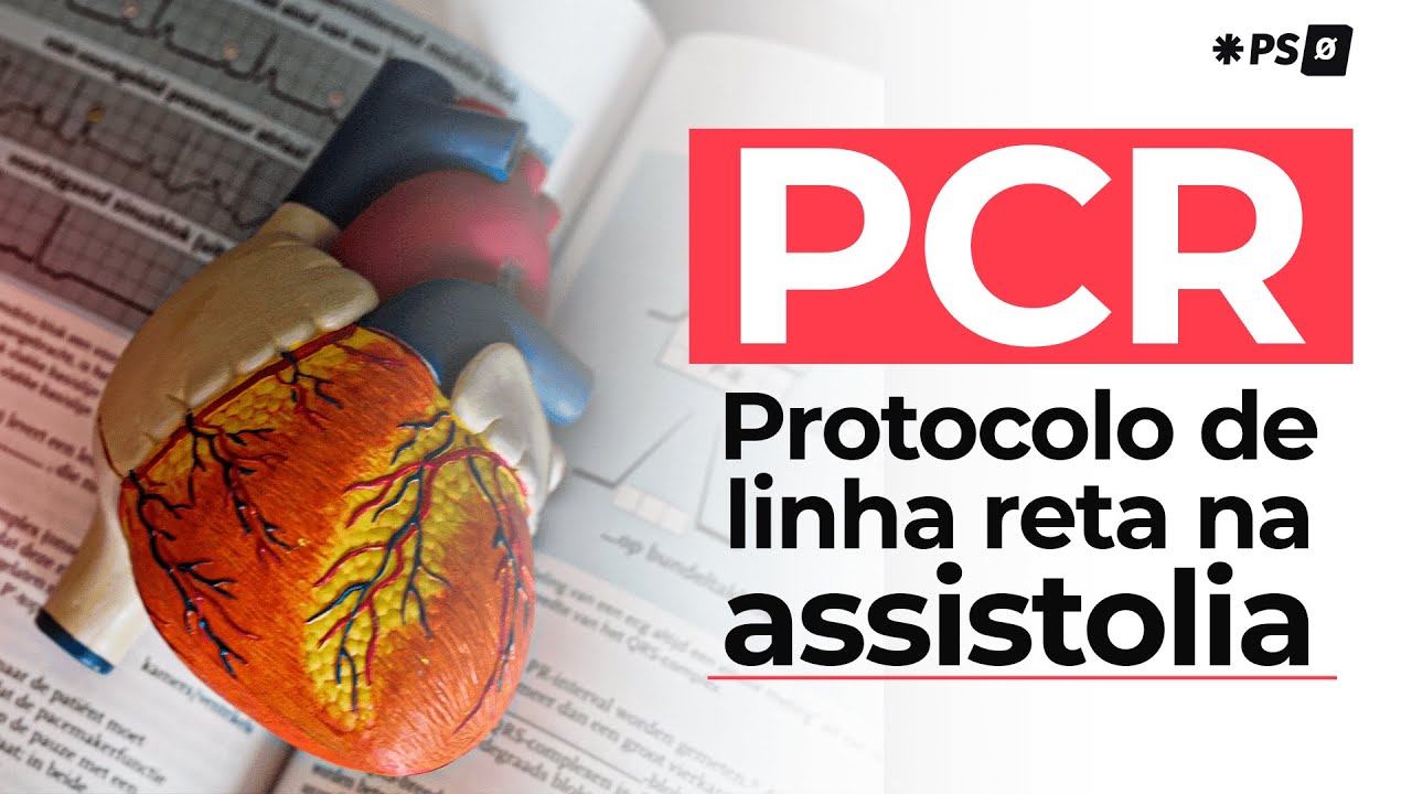 PCR Protocolo de linha reta na assistolia - YouTube