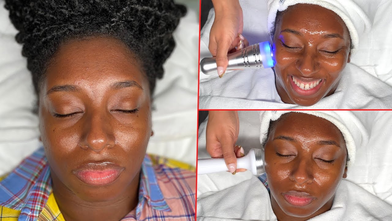 MUST WATCH DERMAPLANE! | Dermaplaning Facial + Cold Therapy - YouTube