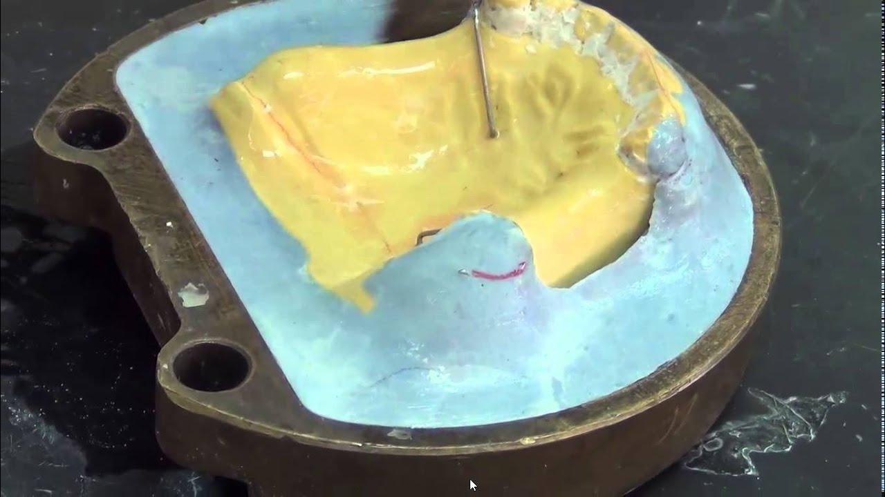 08 Temporary RPD denture processing - YouTube