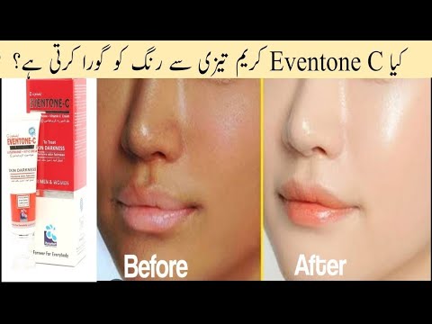 Eventone C medicated Whitening cream Review # Eventone C to Treat Skin ...