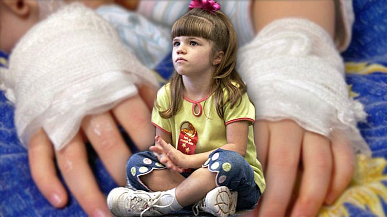 ДЕВОЧКА НЕ ЧУВСТВУЮЩАЯ БОЛИ Эшлин Блокер (Ashlyn Blocker) - YouTube