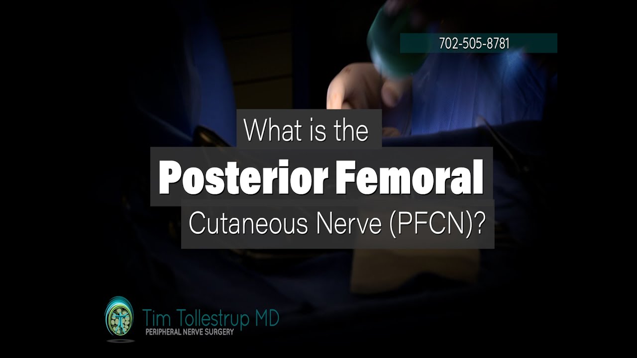 Pain from Damage to the Posterior Femoral Cutaneous Nerve - YouTube