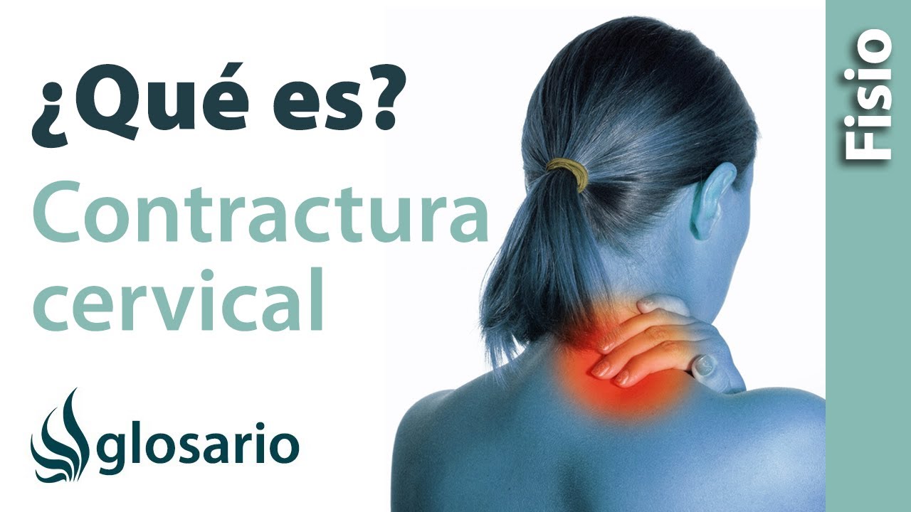 CONTRACTURA CERVICAL | ¿Qué es? - YouTube