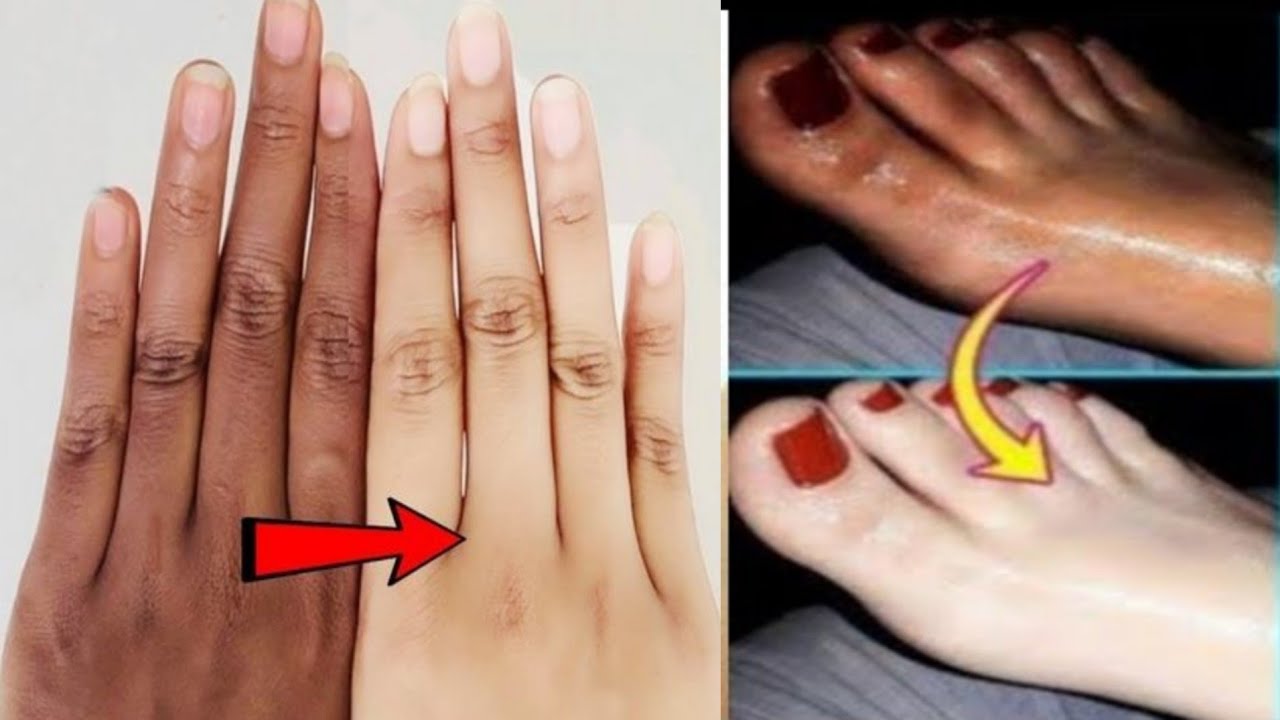 Simple hand whitening cream | Easy and 100% Effective - YouTube