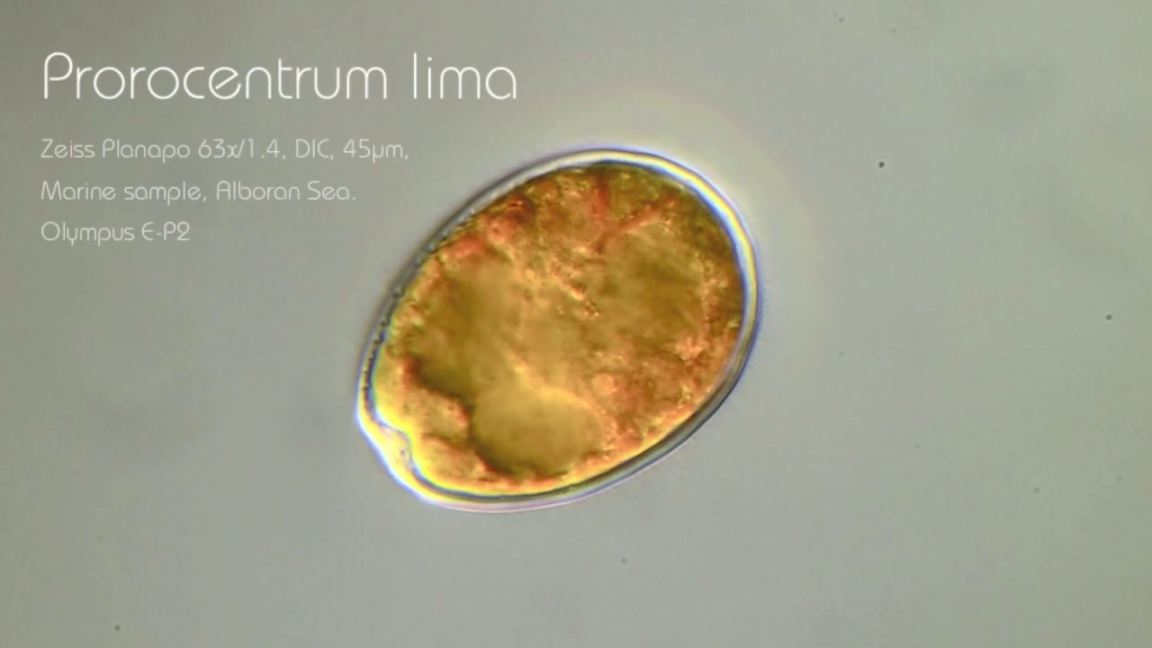 Prorocentrum lima - YouTube