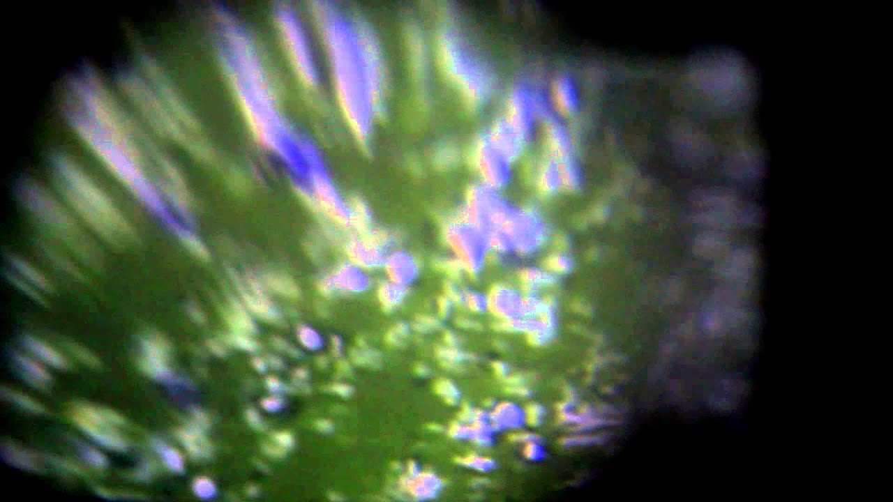 Field Cataract Camera Re Projection - YouTube
