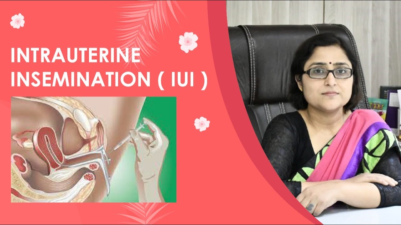 intrauterine insemination ( IUI ) , procedure and sucess rate - YouTube