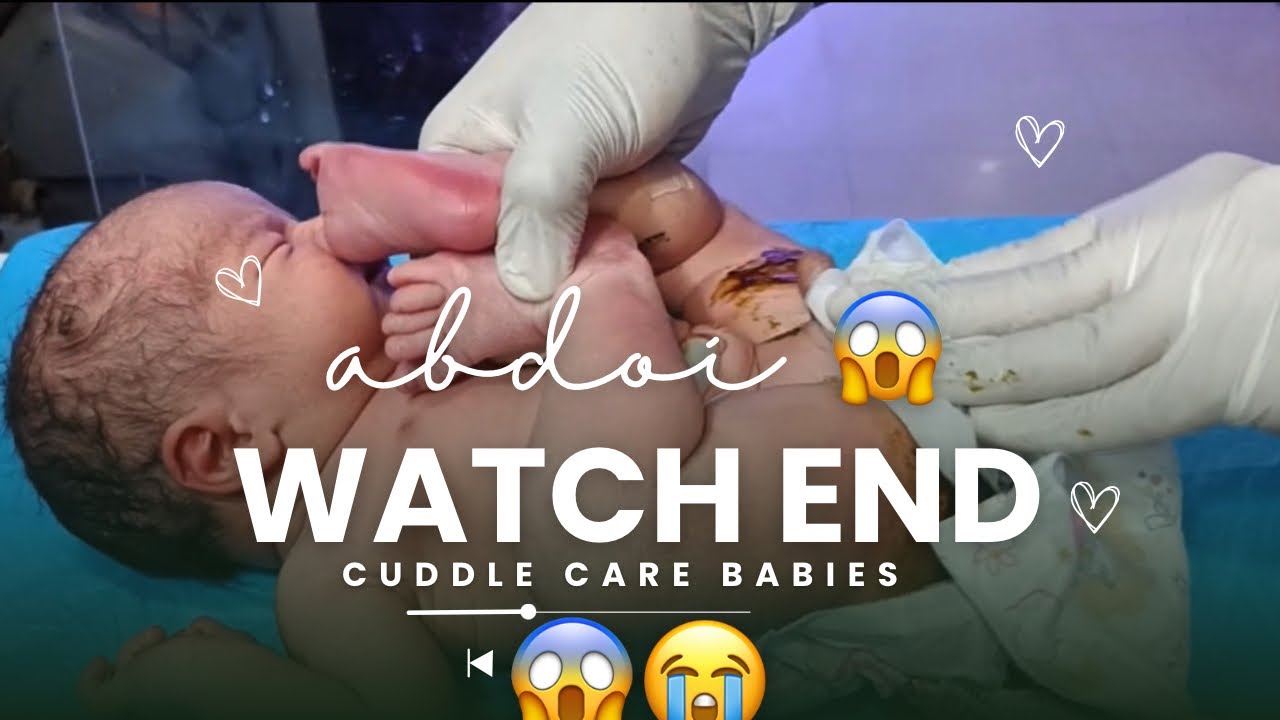 Newborn Baby Abdominal Care | Gentle Cuddle Care Babies Moment.# ...