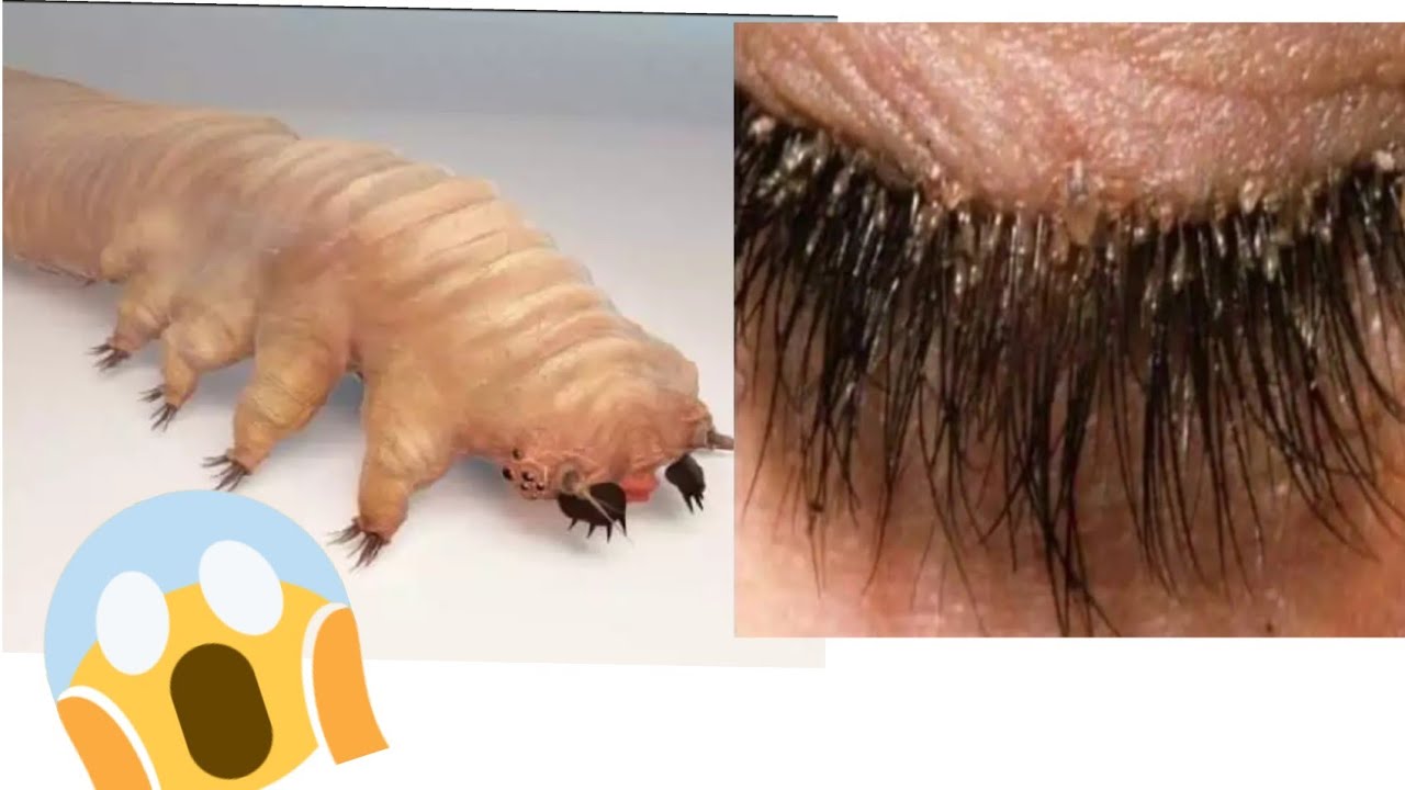 Do you know there is an animal lives on your eyelashes - YouTube