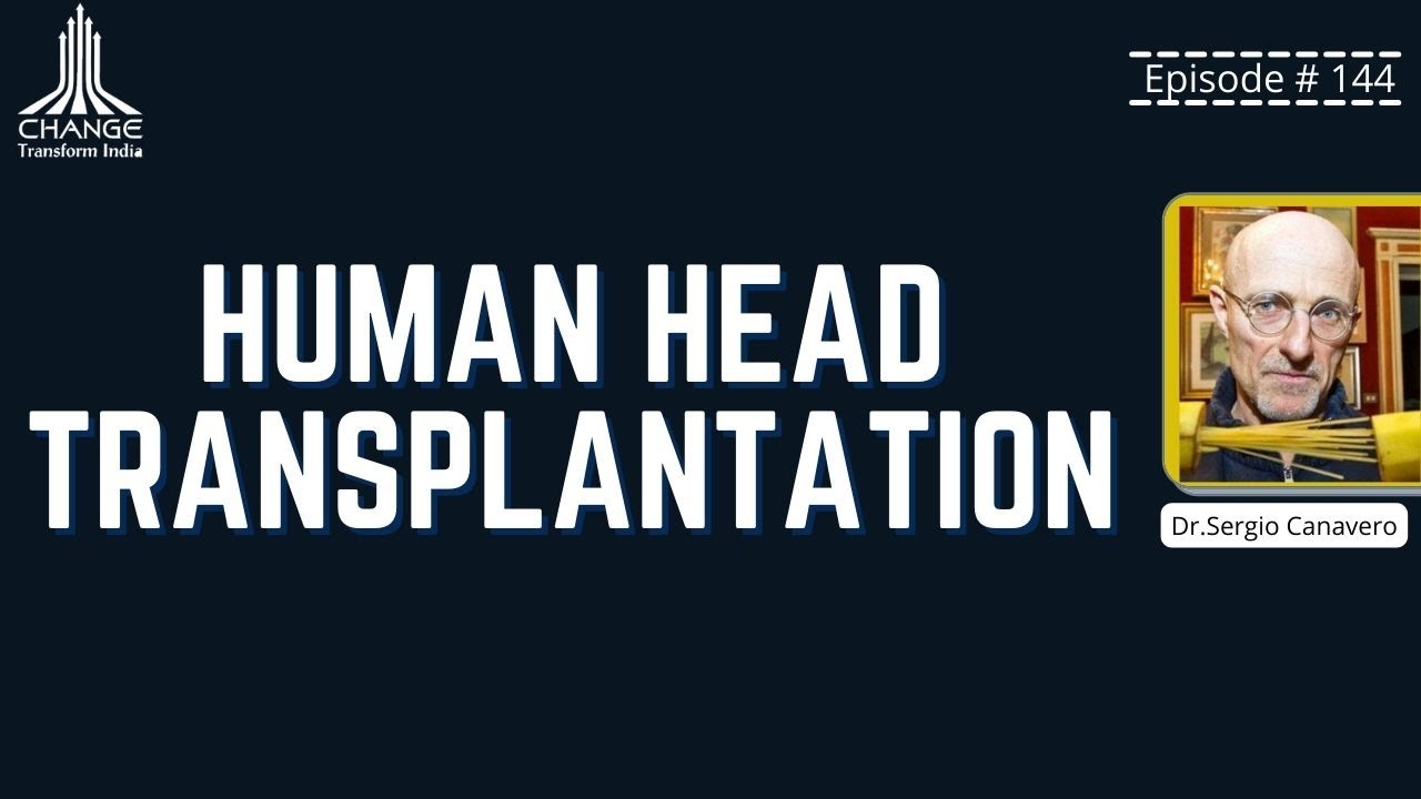 WORLDS 1ST HUMAN HEAD TRANSPLANTATION- DR SERGIO CANAVERO ...