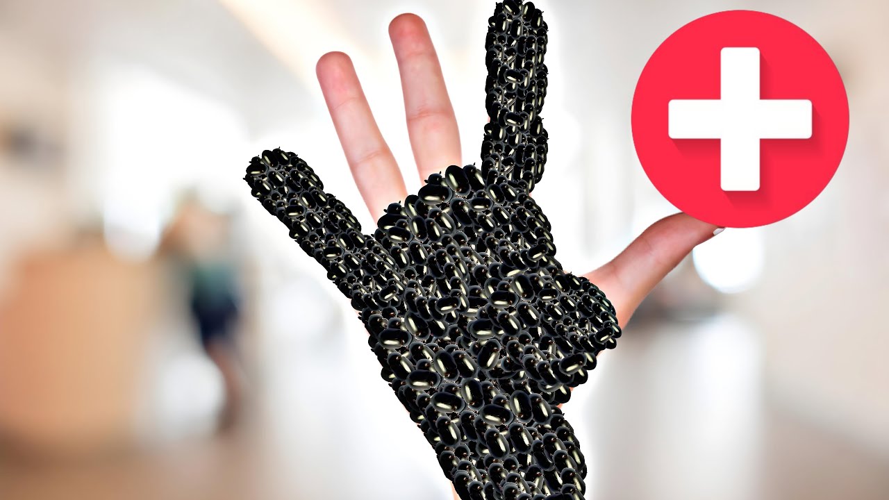 Animation Treatment Hand Asmr | Remove Ticks from Hand | Asmr 2d ...