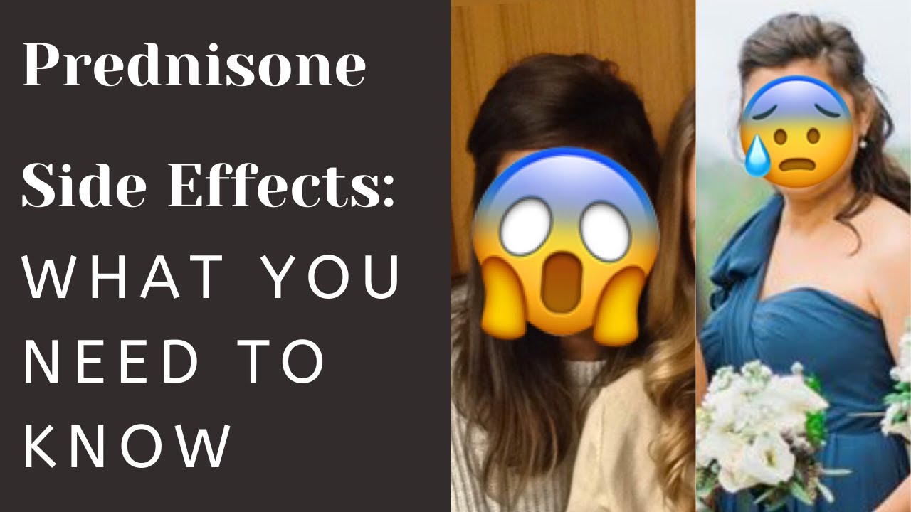 Prednisone Side Effects- 10 things you NEED to know about steroids ...
