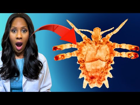 PUBIC LICE (“CRABS”): What Are Symptoms? How is it Spread? What Are Treatments?! A Doc Explains