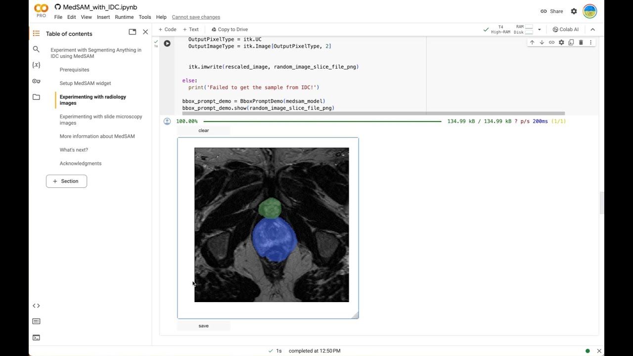 Colab notebook demonstrating MedSAM applied to DICOM data in Imaging ...