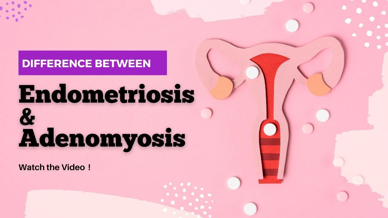 Difference between Endometriosis & Adenomyosis - YouTube