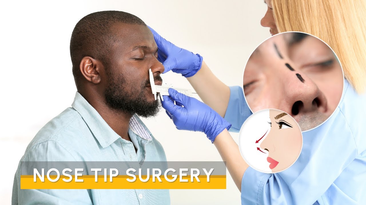 Rhinoplasty (Nose Job) in Turkey - Turquie Santé - YouTube