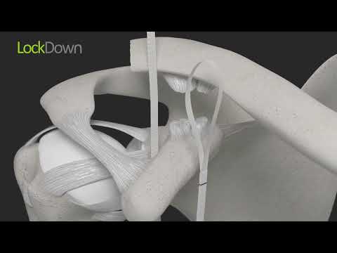 LockDown ACJ Animation