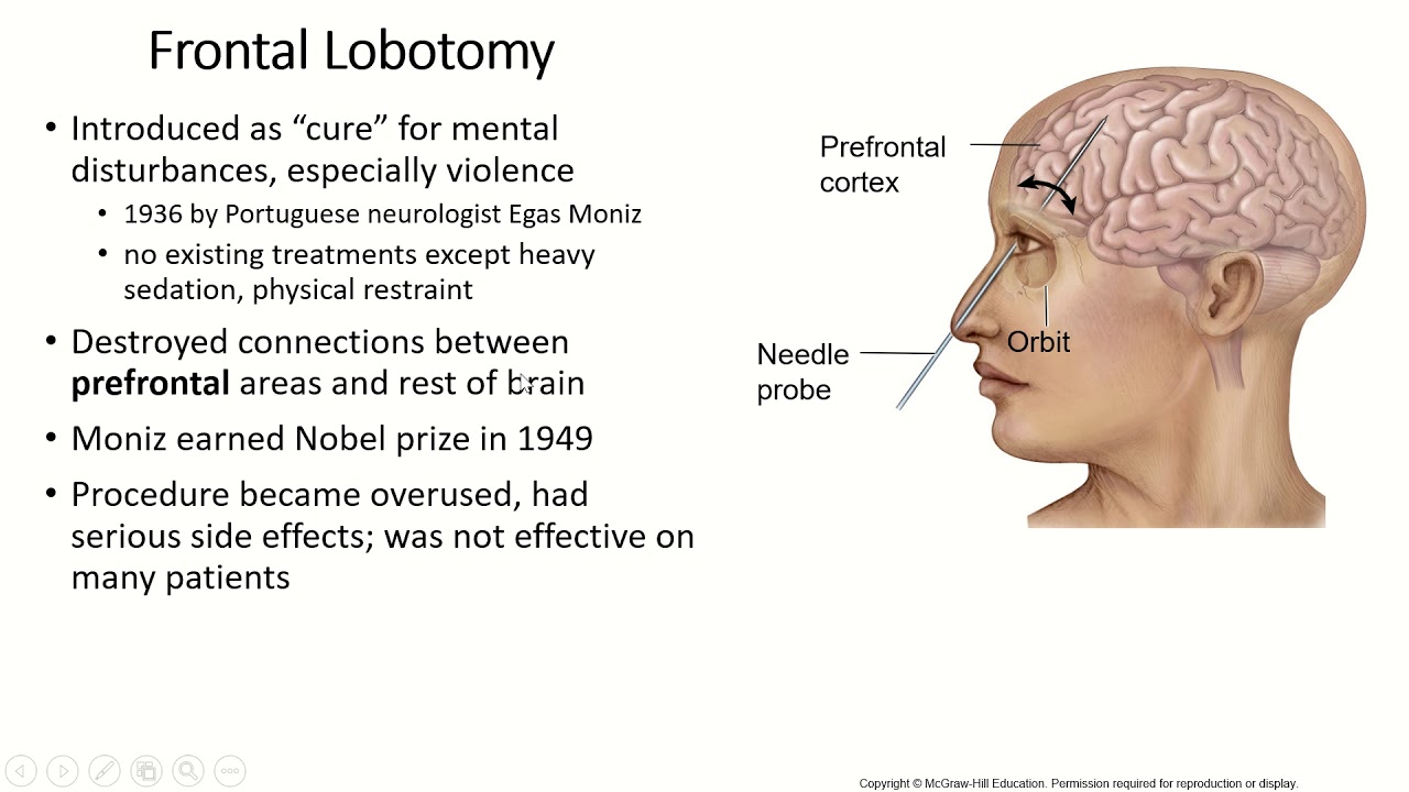 Ch15 Pt2 Brain, Cortices of the Frontal Lobe - YouTube