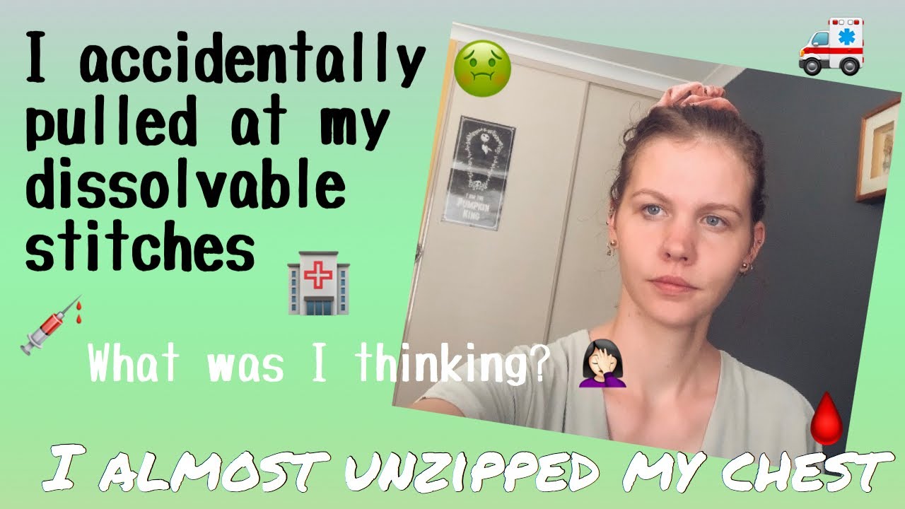 STORY TIME! How I almost pulled my stitches out - YouTube